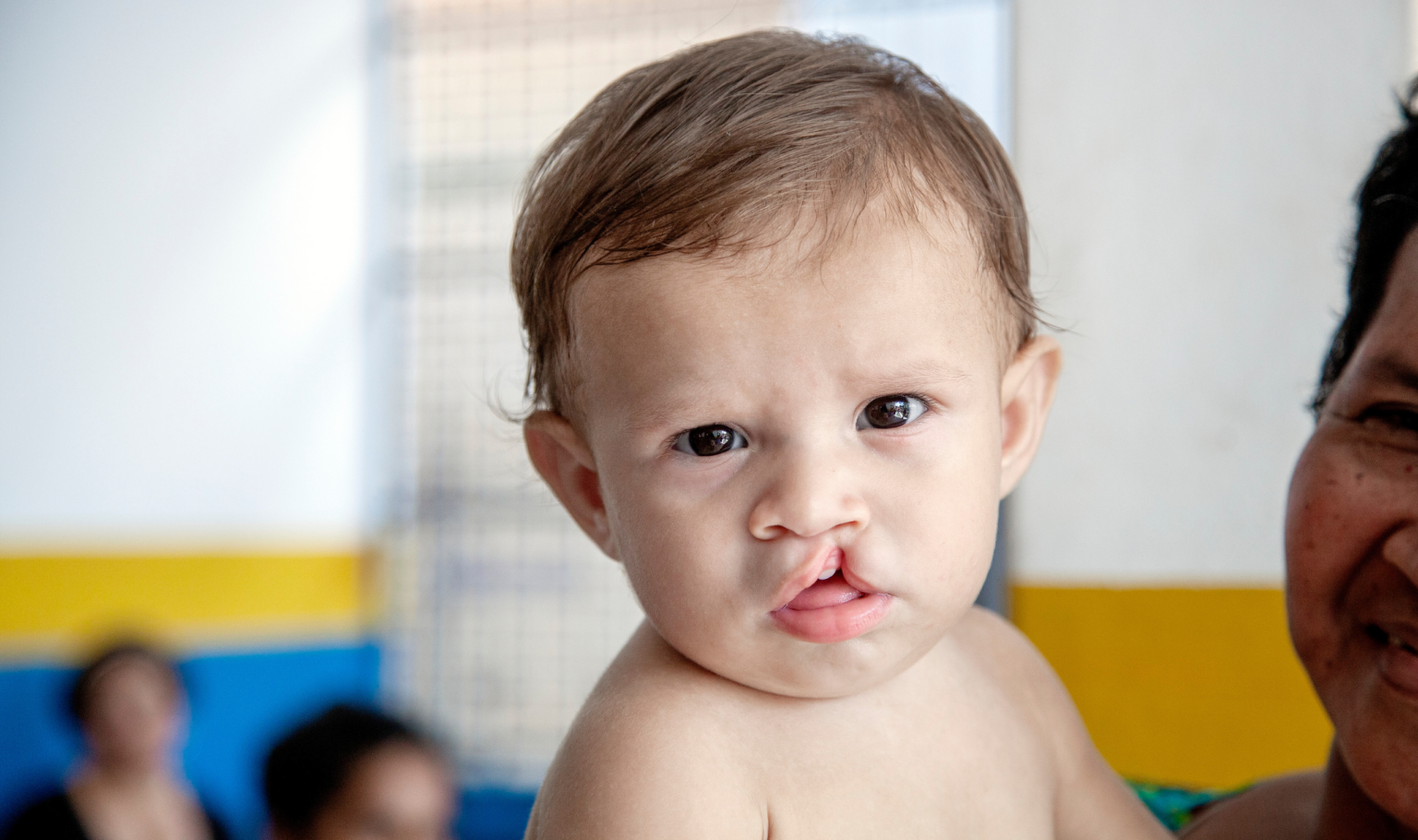 Cleft Lip & Cleft Palate Children's Charity - Cleft Lip & Palate ...